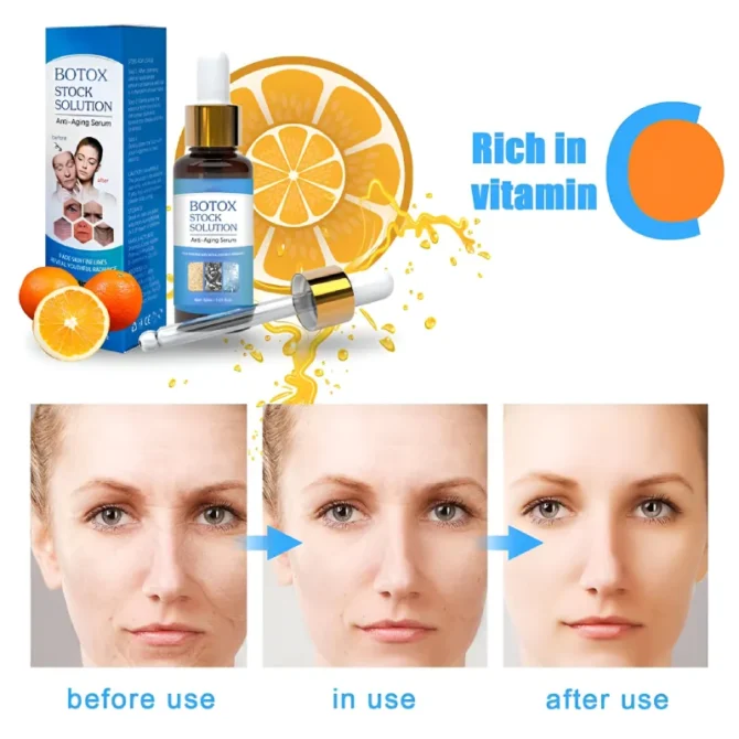 Botox Stock Solution Suero Antiarrugas Facial